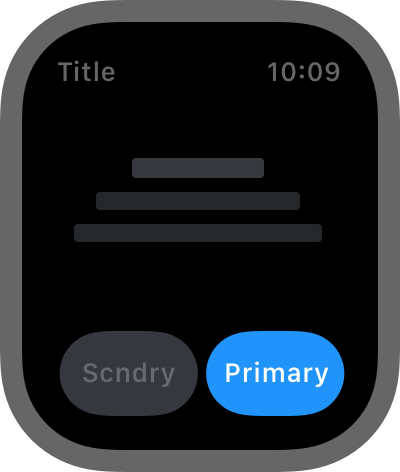 Alerts | Apple Developer Documentation